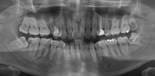 Oral Surgery - London Specialist Dentists